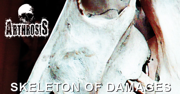 CD EP ARTHROSIS Skeleton of Damages